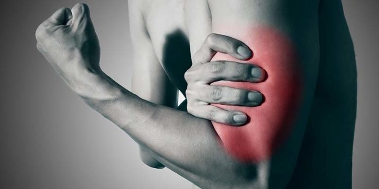 Tendinitis del Bíceps Braquial - Clínica FisioVida